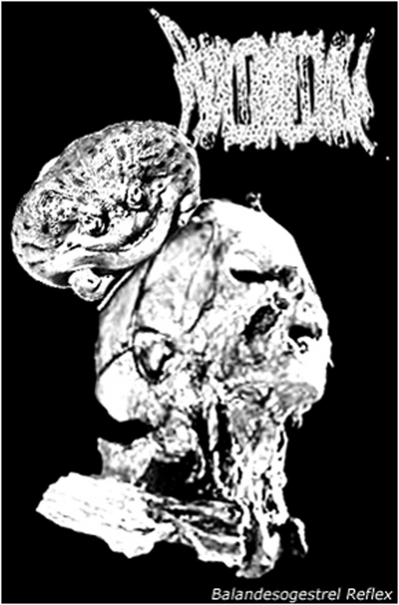 Phyllomedusa - Balandesogestrel Reflex/Frogs - Reviews - Album of The Year