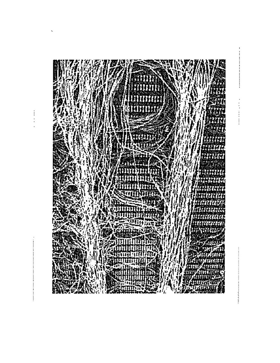 Photophobik - Dystonium - Reviews - Album of The Year