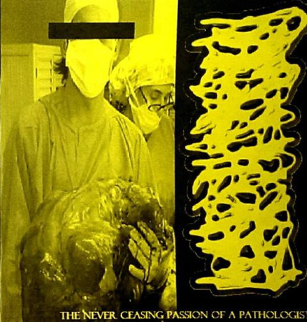 Hydrocephalus - The Never Ceasing Passion of a Pathologist (EP ...