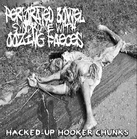 Perforated Bowel Syndrome With Oozing Faeces - Hacked-Up Hooker Chunks ...