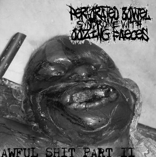 Perforated Bowel Syndrome With Oozing Faeces - Awful Shit Part II (EP ...