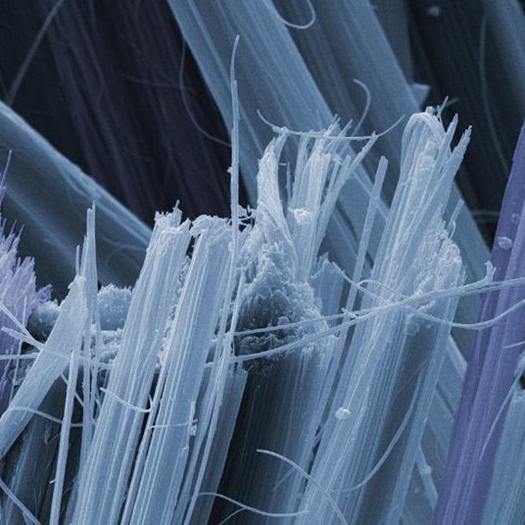 ksuuvi - asbestos (Single) - Reviews - Album of The Year