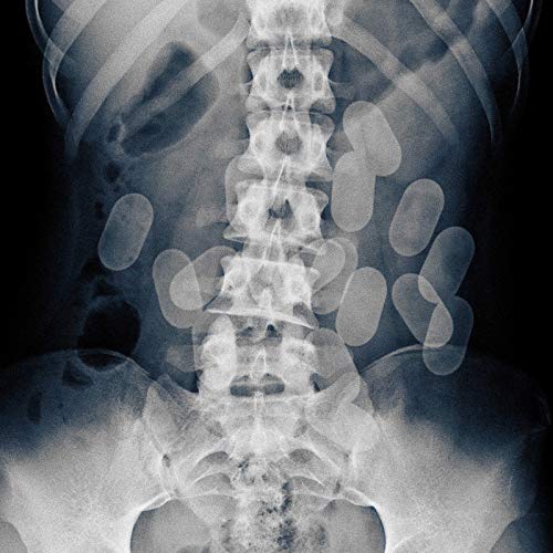 Night Skinny - Mattoni X-Ray (Instrumental) - Reviews - Album of The Year