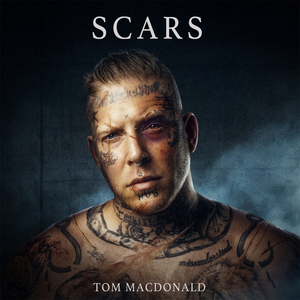 Tom MacDonald - Scars (Single) - Reviews - Album of The Year