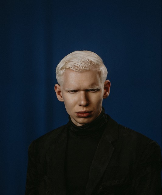 Albino Albums, Songs - Discography - Album of The Year